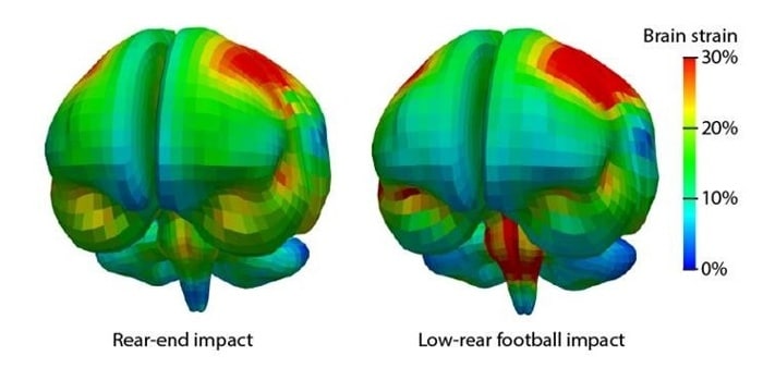 Concussion and Whiplash Injury - MEA Forensic