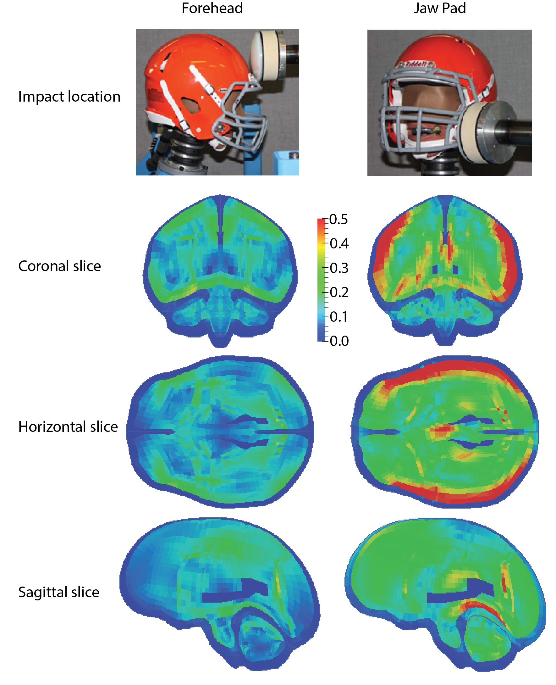 Football helmet impact location, possible factor in mTBI - MEA Forensic